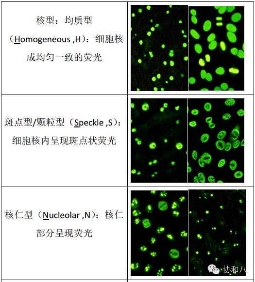 如何才能读懂你,我的抗核抗体丨一页手册·协和八